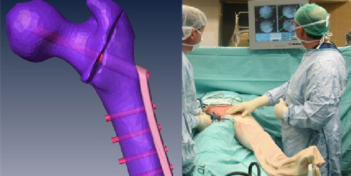 EXPO21XX - computeraided orthopaedic model cunstruction visualization ...