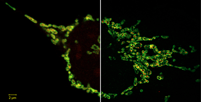 ZEISS Airyscan area detector offers higher sensitivity, resolution and ...